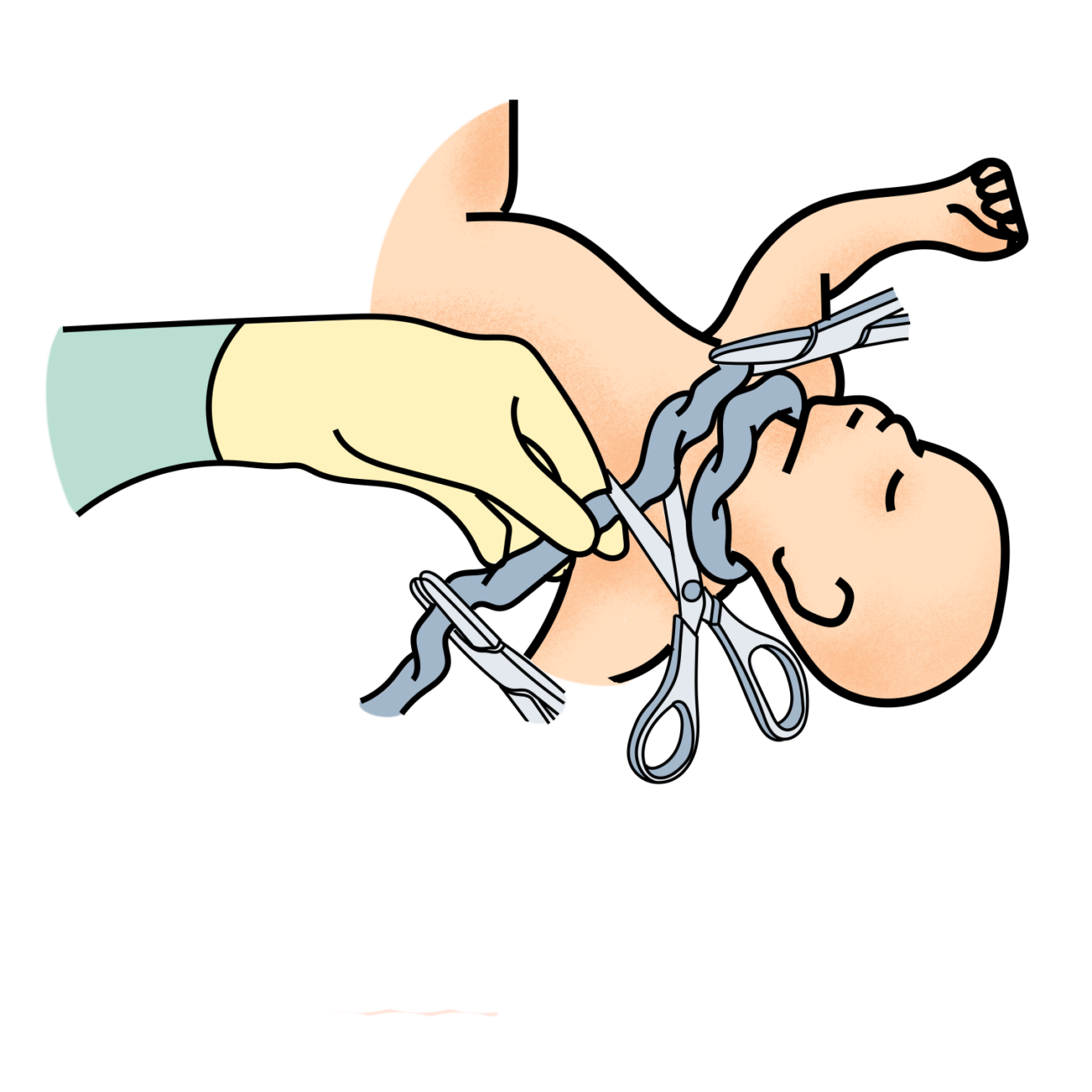 Accouchement par Voie Basse Physiologique - Obstetricks