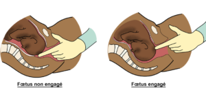 Diagnostic engagement - Obstetricks